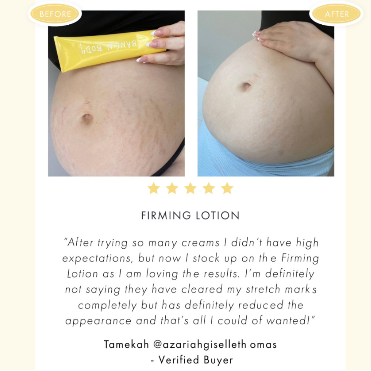 Mummy Bump Bundle | For Mums & Mums To Be | Bangn Body